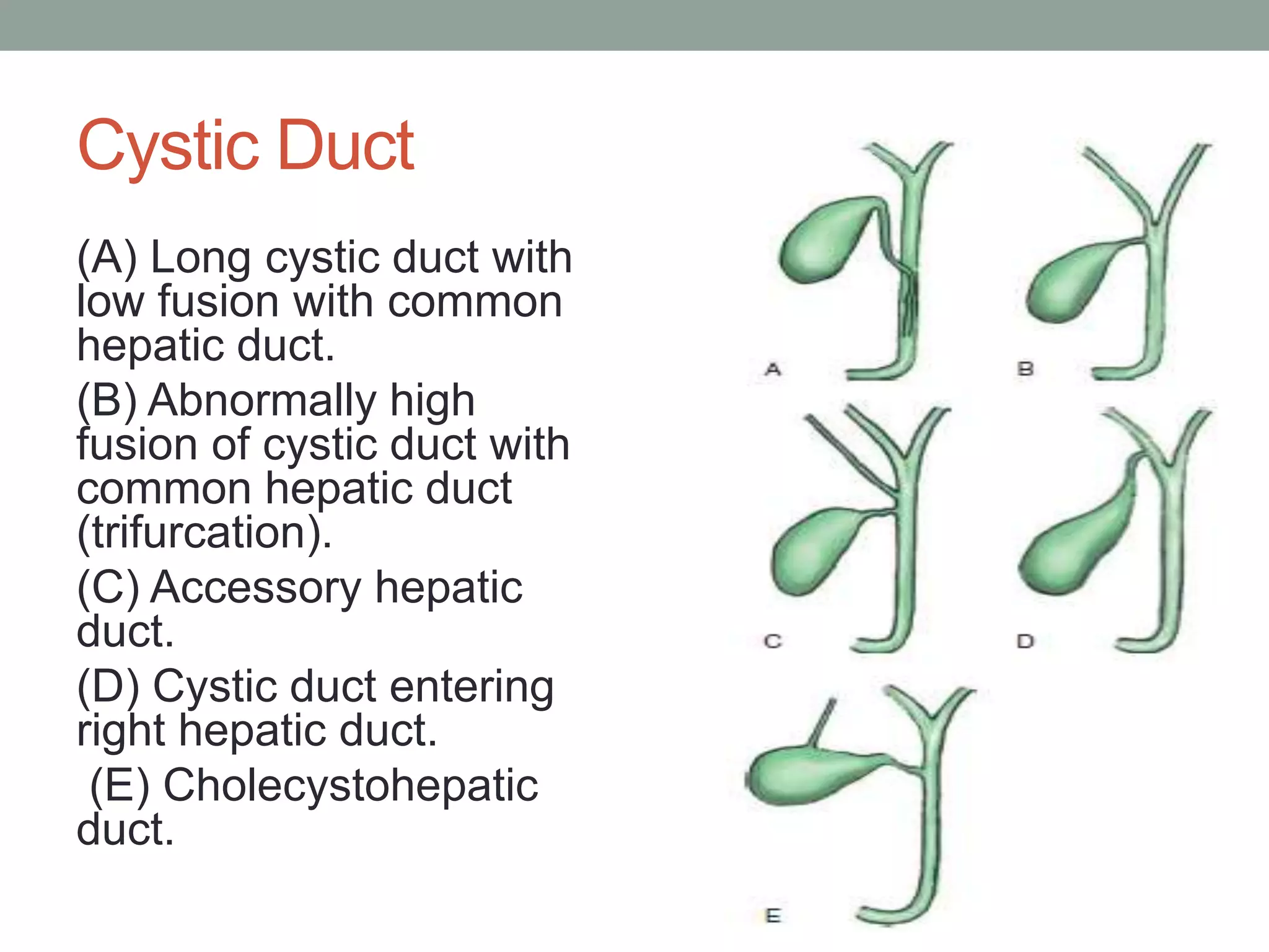 Bile duct injuries BDI | PPTX