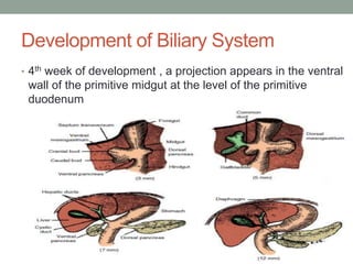 Bile duct injuries BDI | PPTX