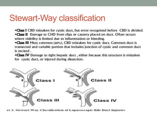 Stewart Way Classification