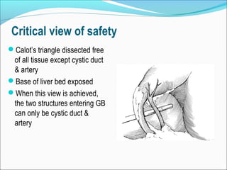 Critical View Of Safety