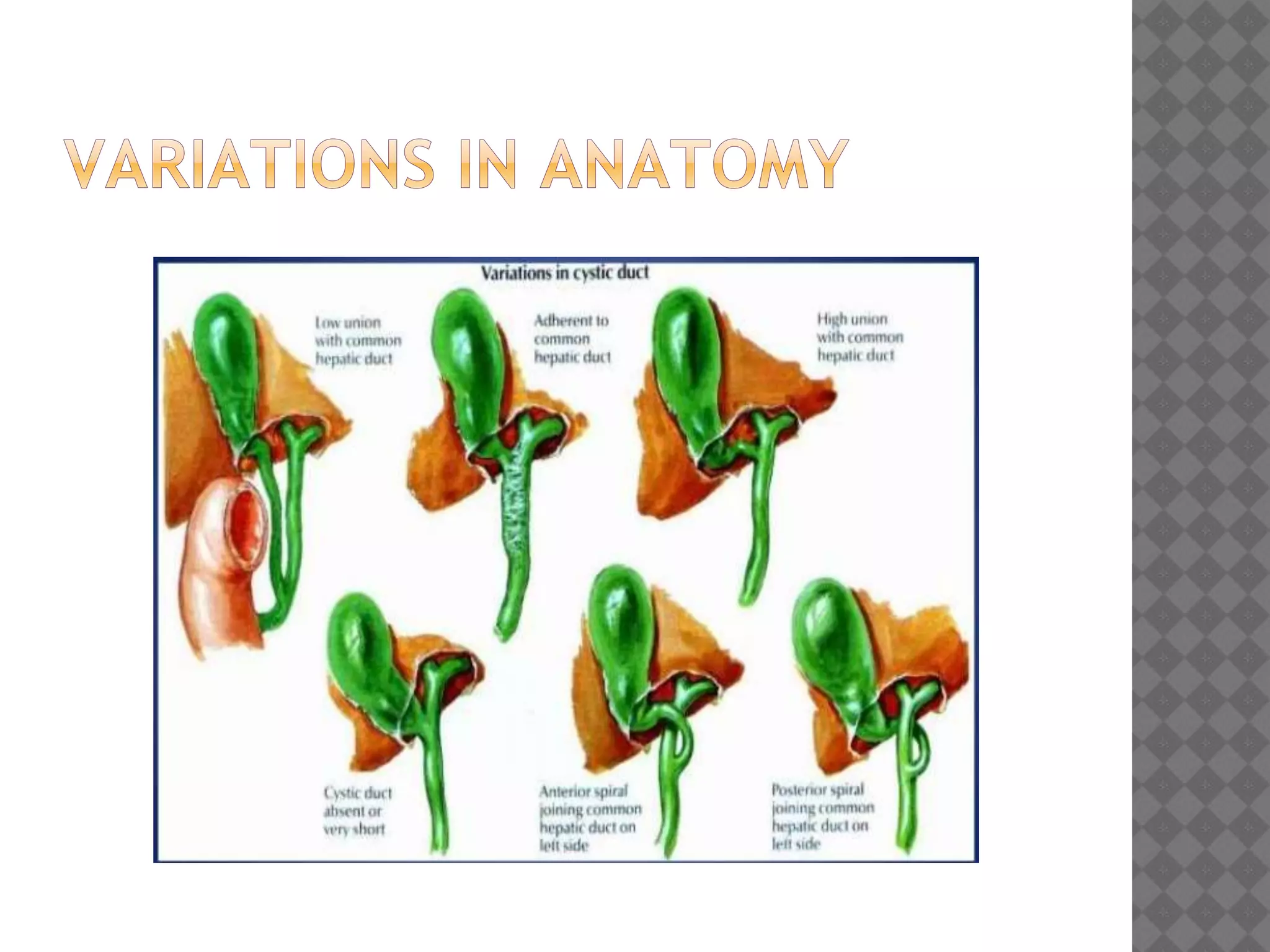 Bile duct injuries | PPTX | Digestive Disorders | Diseases and Conditions