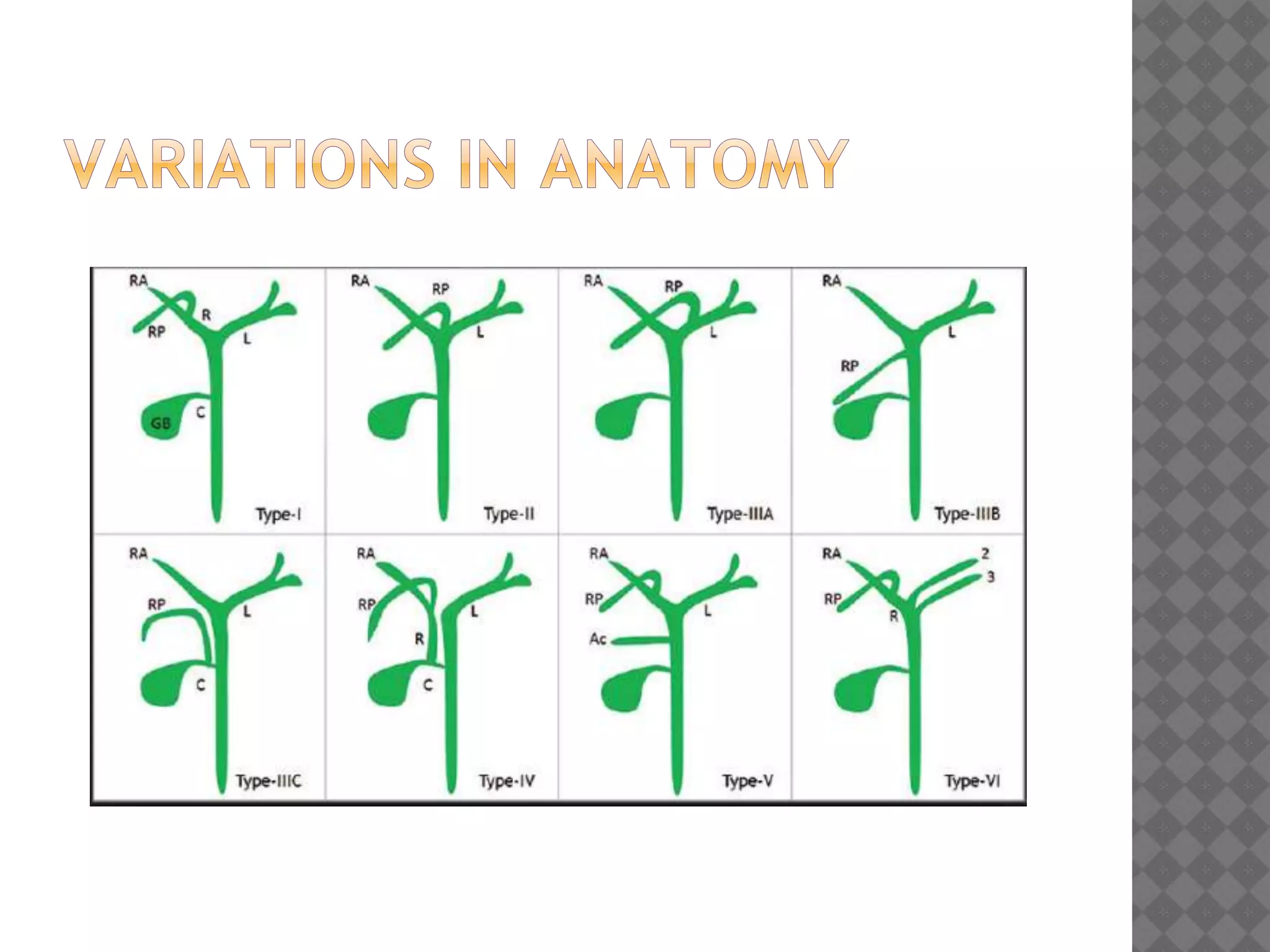 Bile duct injuries | PPTX | Digestive Disorders | Diseases and Conditions