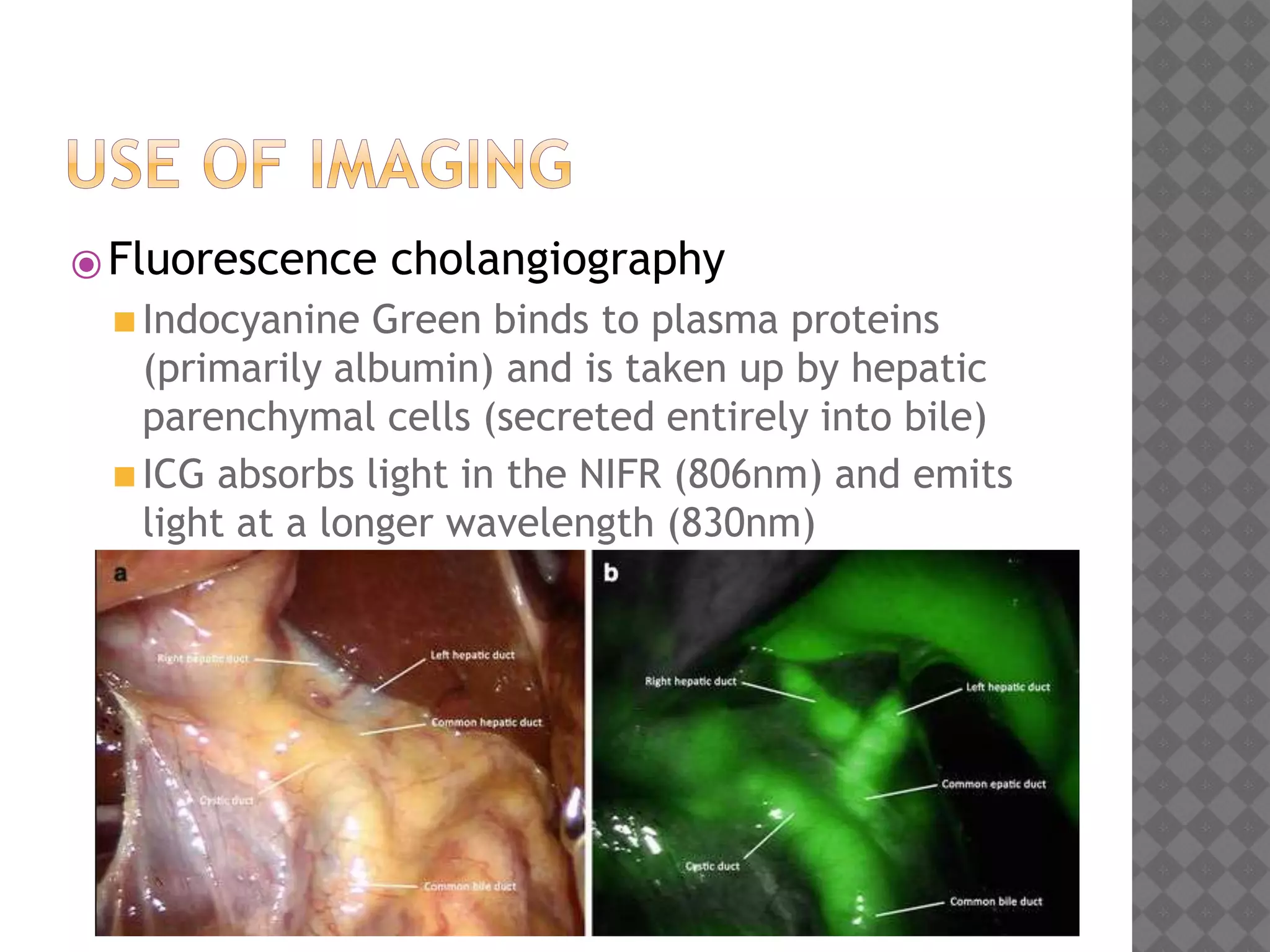 Bile duct injuries | PPTX | Digestive Disorders | Diseases and Conditions