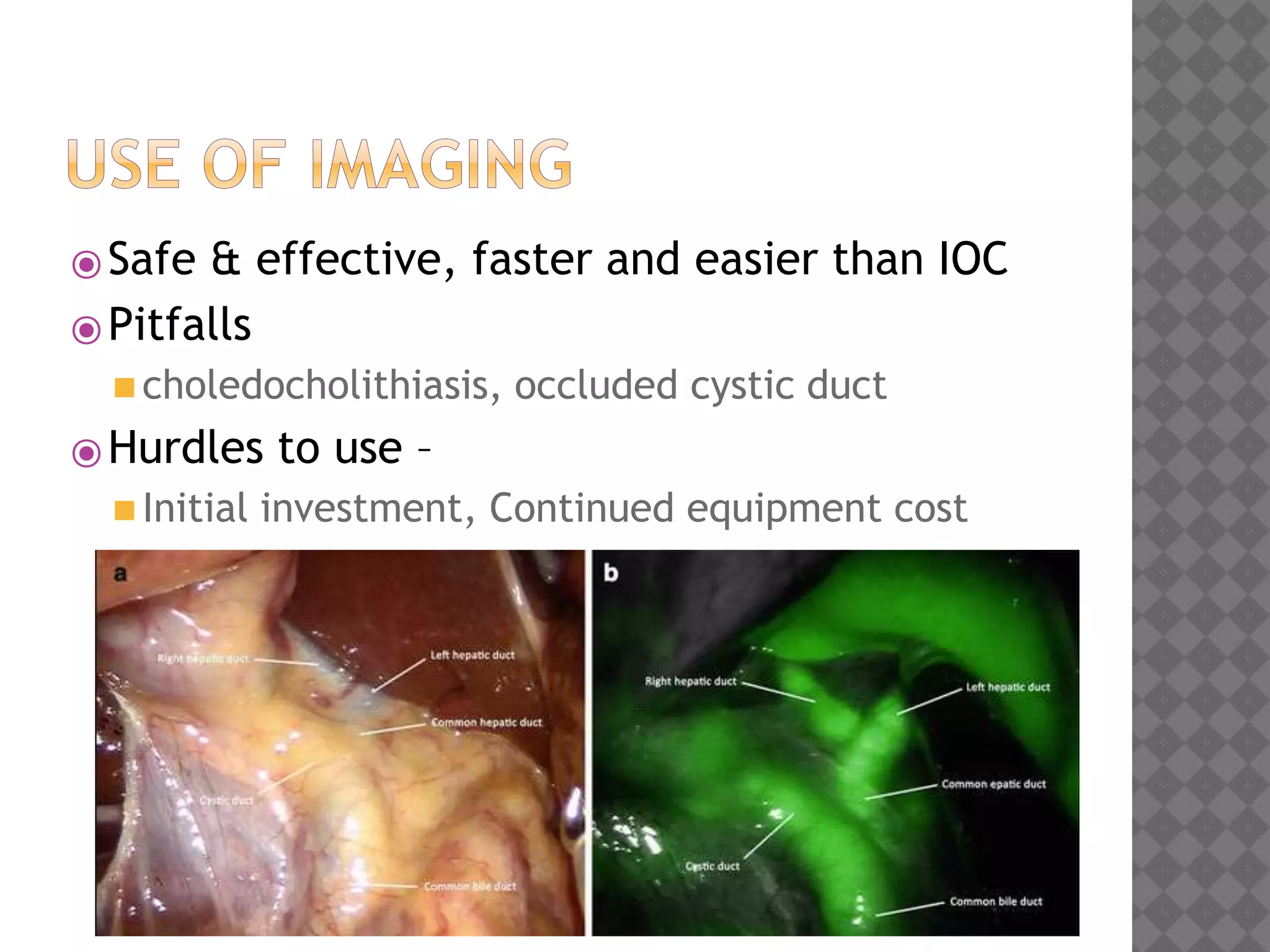 Bile duct injuries | PPTX | Digestive Disorders | Diseases and Conditions