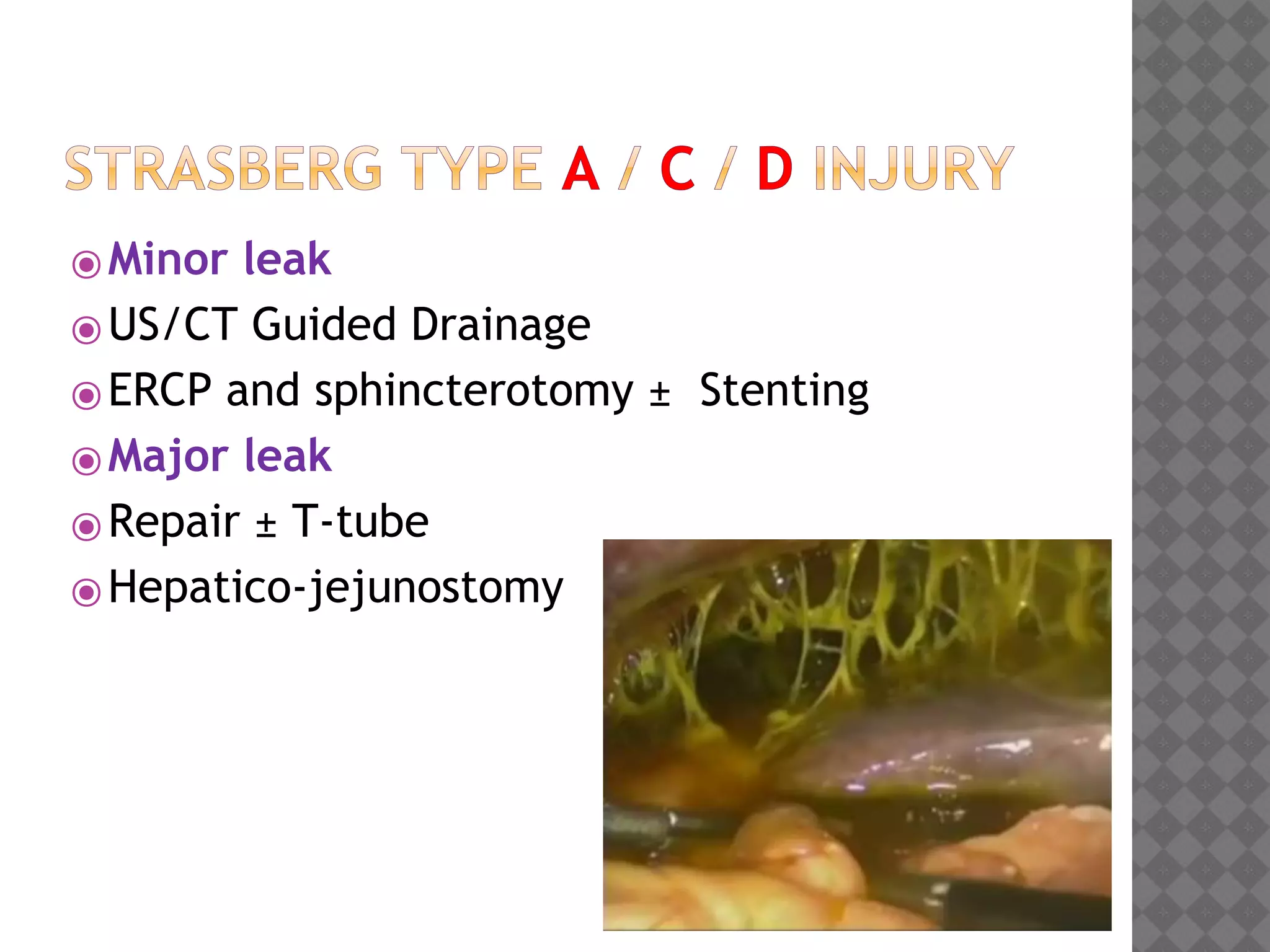 Bile duct injuries | PPTX | Digestive Disorders | Diseases and Conditions