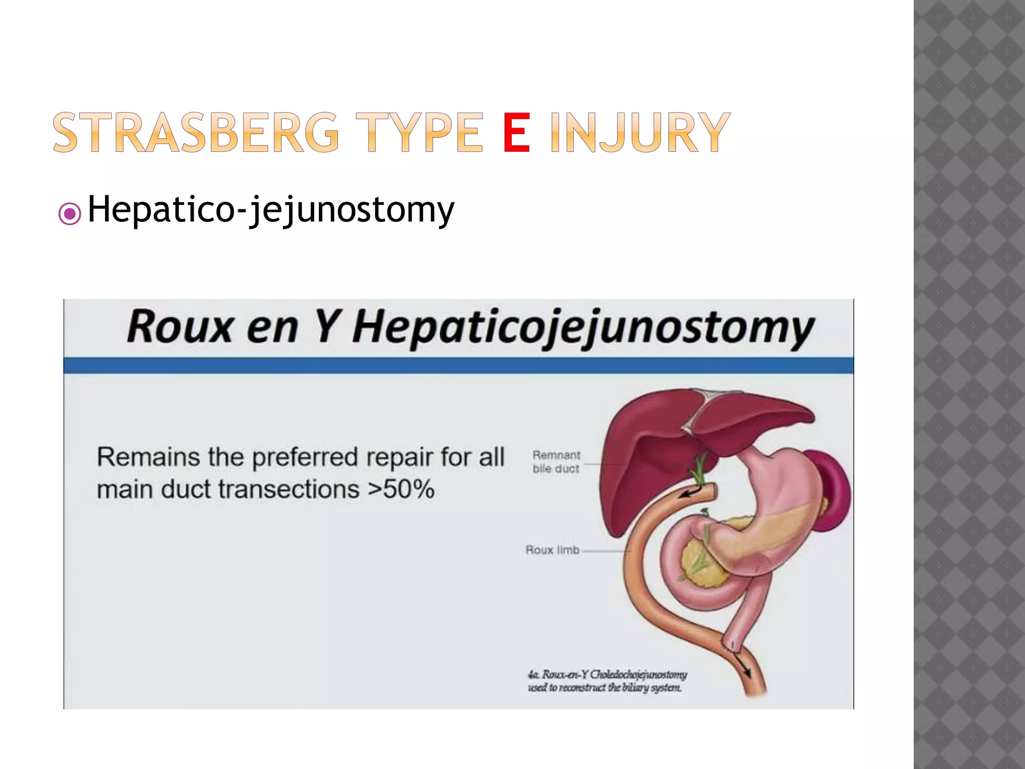 Bile duct injuries | PPTX | Digestive Disorders | Diseases and Conditions