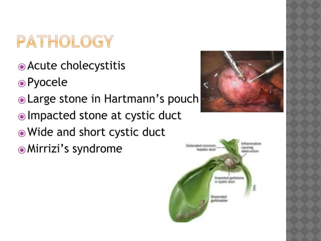 Bile duct injuries | PPTX | Digestive Disorders | Diseases and Conditions