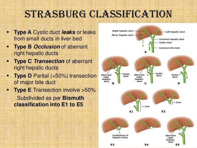 Bile duct injuries in Laparocsopic cholecystectomy