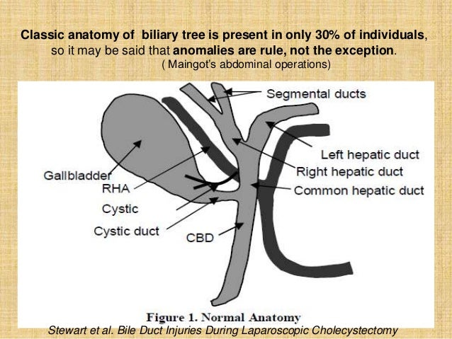 Bile duct injuries in Laparocsopic cholecystectomy