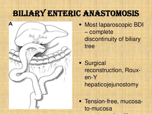 Bile duct injuries in Laparocsopic cholecystectomy