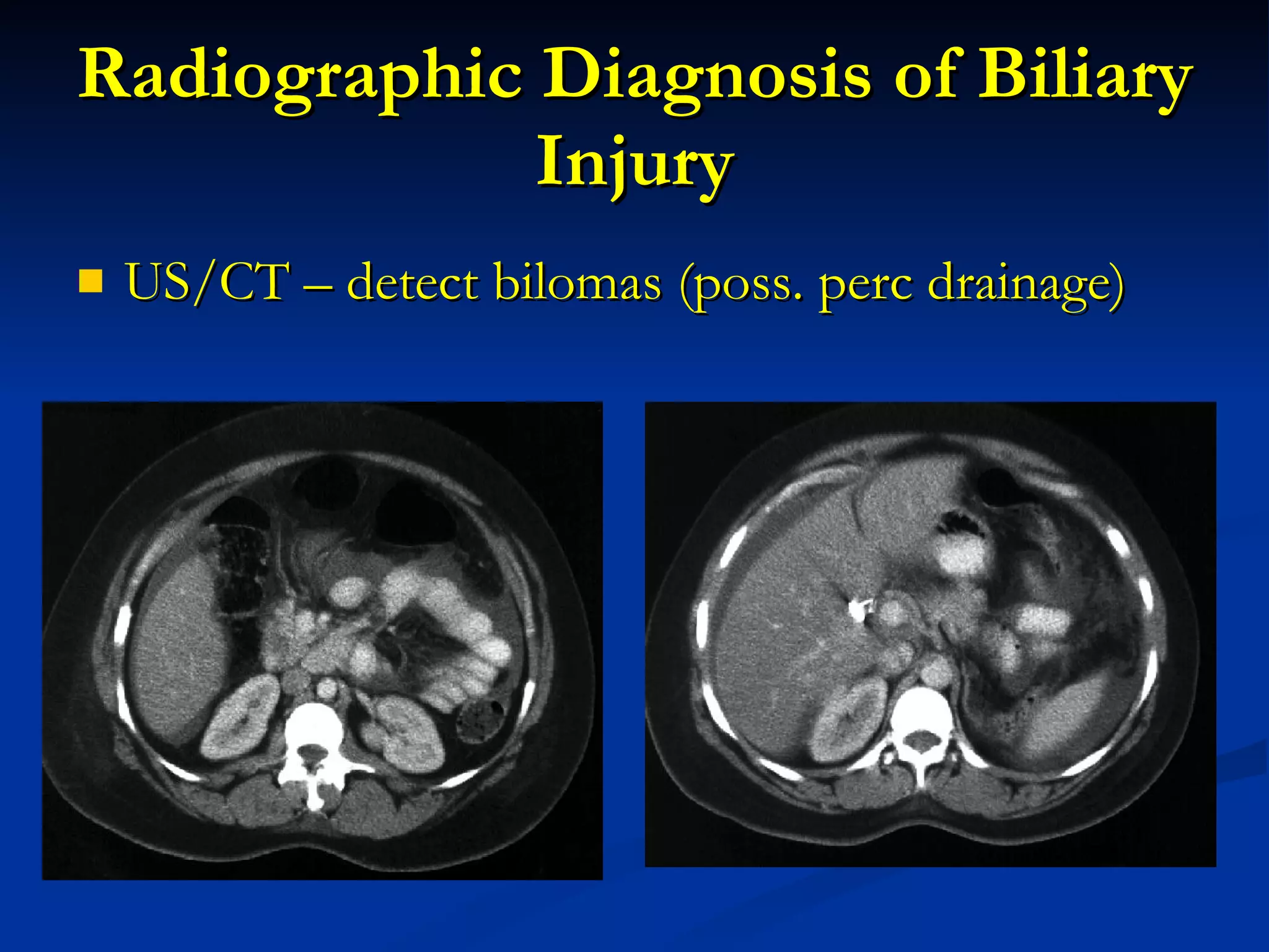 Bile duct injury:How safe is emergency laparoscopic cholecystectomy? | PPT