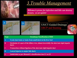 Bile duct injury during laparoscopic cholecystectomy | PPT