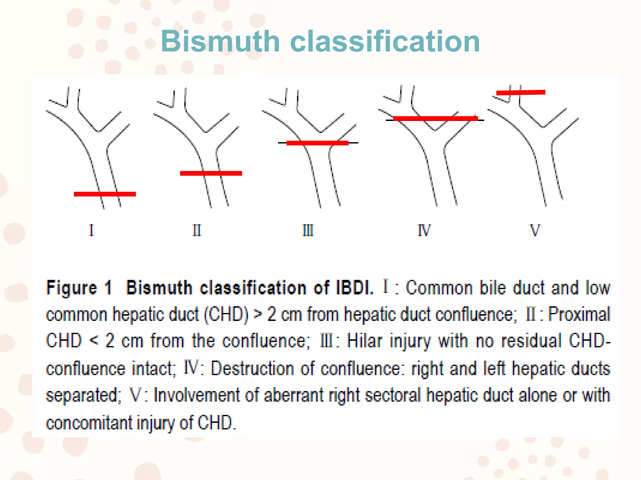 Bile duct injury | PPTX