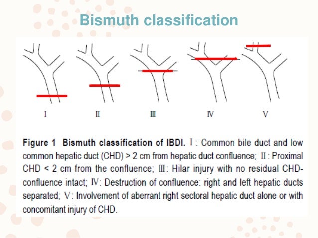 Bile duct injury