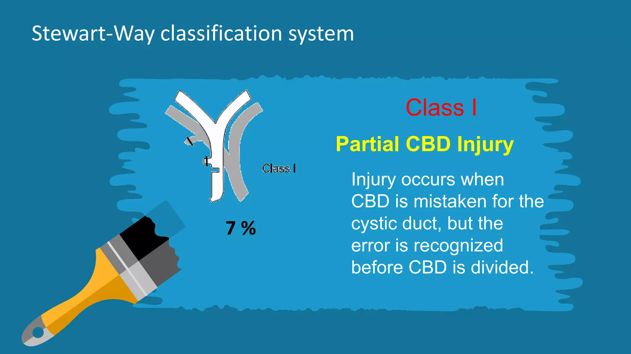 Bile Duct Injury and Post Cholecystectomy Biliary Stricture | PPTX