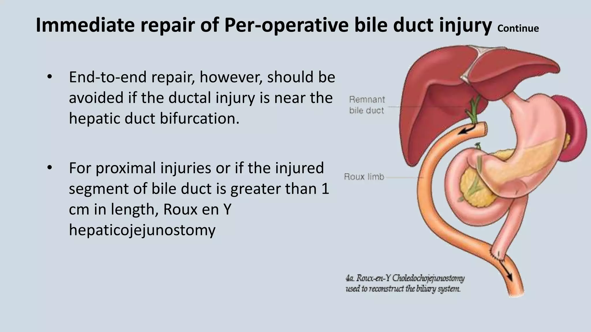 Bile Duct Injury and Post Cholecystectomy Biliary Stricture | PPTX