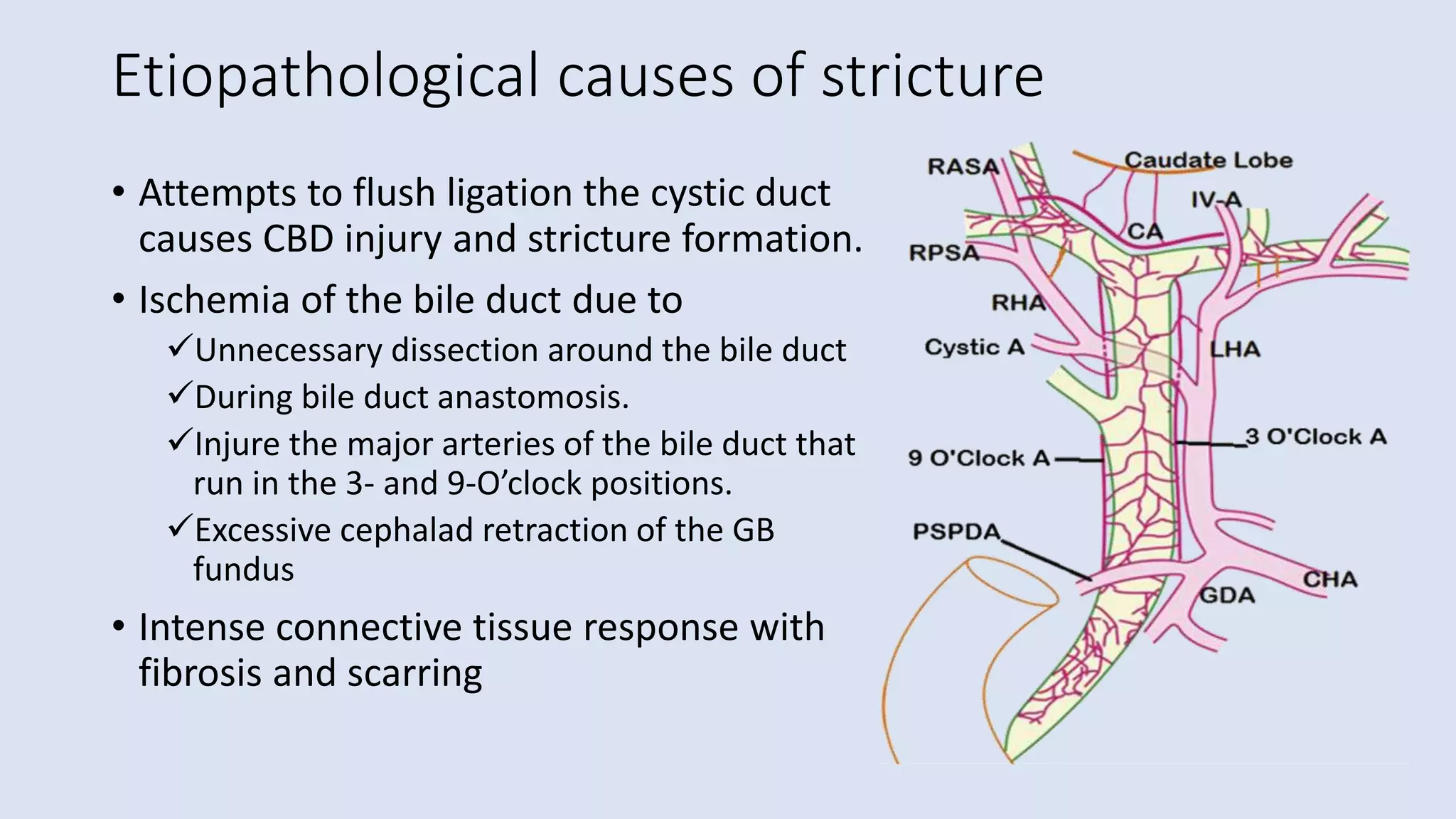 Bile Duct Injury and Post Cholecystectomy Biliary Stricture | PPTX