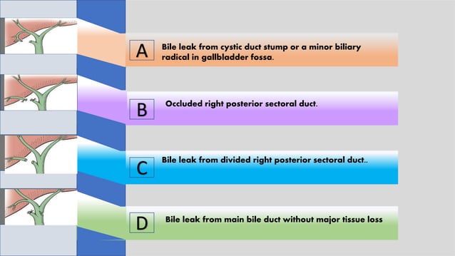Bile Duct Injury and Post Cholecystectomy Biliary Stricture | PPTX