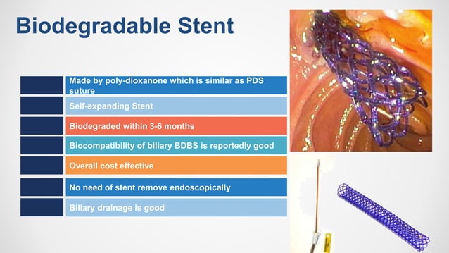 Bile Duct Injury and Post Cholecystectomy Biliary Stricture | PPTX