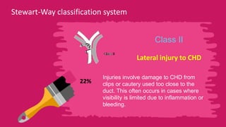 Stewart Way Classification