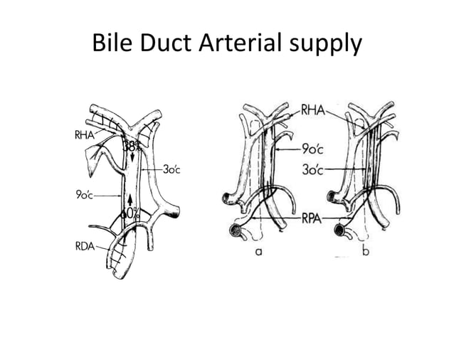 Bile duct injury | PPTX