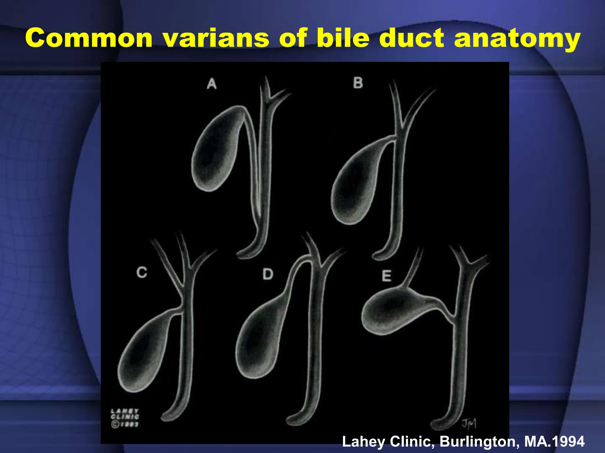 BILE DUCT INJURY 09-05.ppt