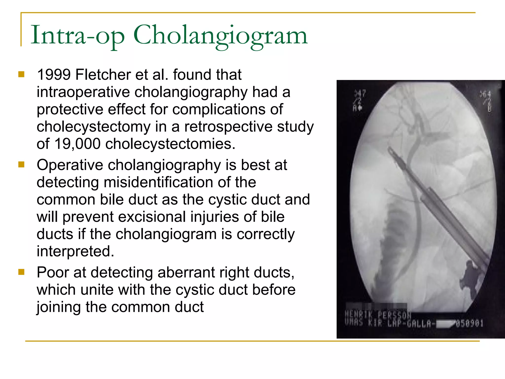 Bile leaks after lapchole Nir Hus MD., PhD. | PPT
