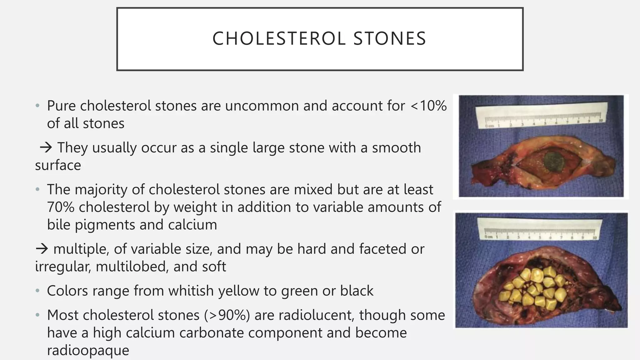 Bile physiology.pptx