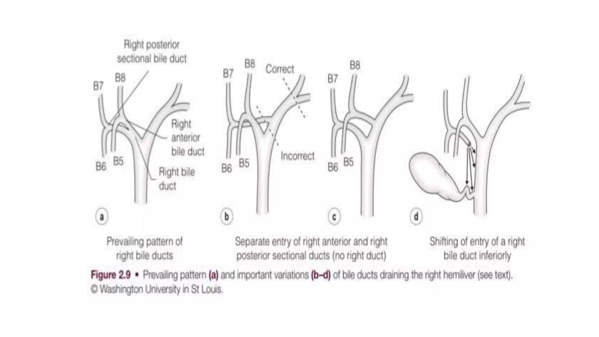 BILE TRACT ANATOMY.ppt