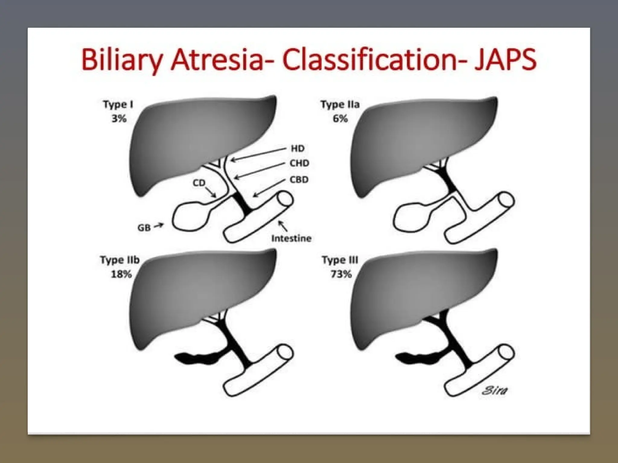 Biliary Anatomy, ATRESIA , CHOLEDOCHAL CYST.pptx