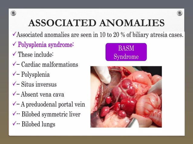 Biliary Anatomy, ATRESIA , CHOLEDOCHAL CYST.pptx