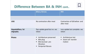 biliaryatresia Composed by Dr saad Malik | PDF