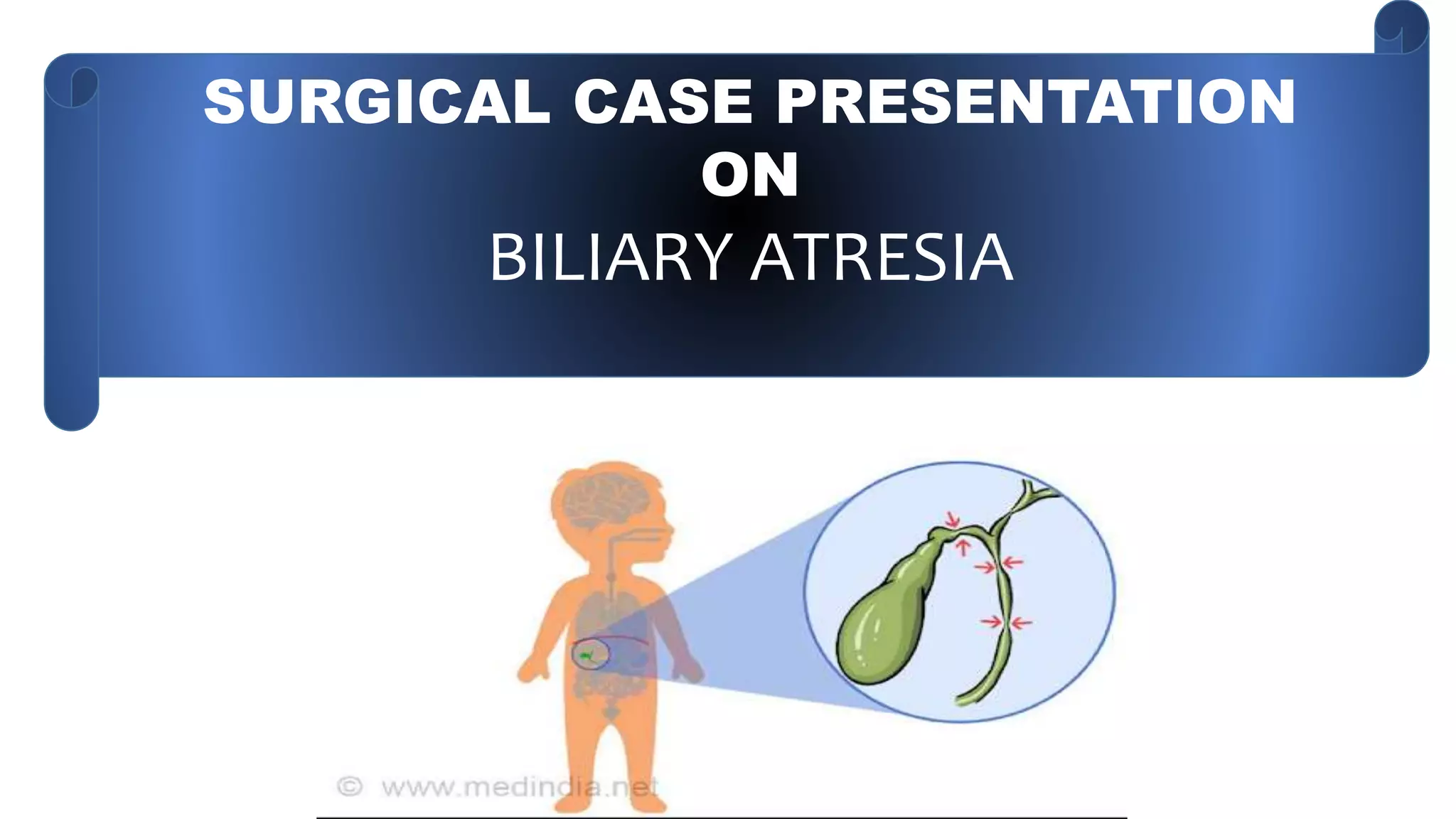 Biliary atresia | PPTX