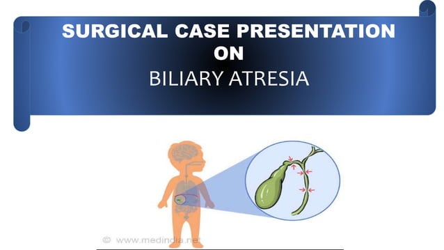 Biliary atresia | PPTX