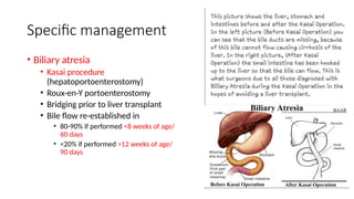 Biliary atresia critical case in pediatrics scenario.pptx
