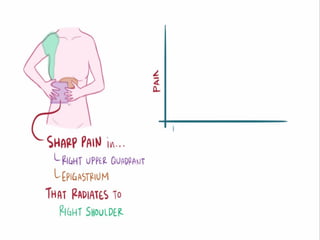 BILIARY COLIC Ppt for under graduate students | PPTX