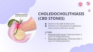 Biliary Tract Diseases including gallstones, CBD stones and ...