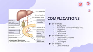 Biliary Tract Diseases including gallstones, CBD stones and ...