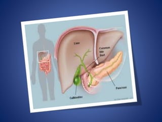 Biliary disorders | PPTX