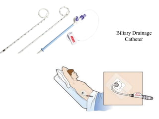 Biliary drainage | PPTX