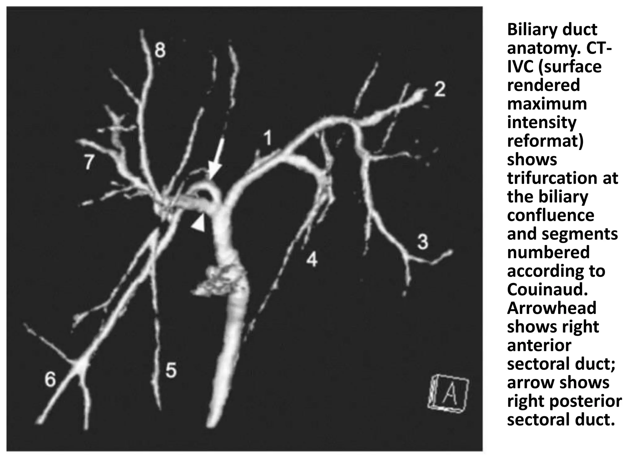 Biliary pathologies | PPTX