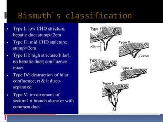 Biliary stricture ppt | PPTX