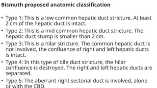 CAUSES OF BILIARY STRICTURES AND ITS MANAGEMENT | PPTX