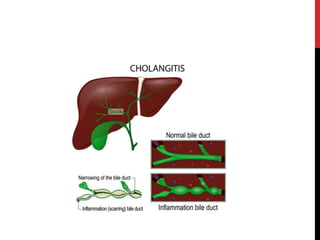 Biliary system disease2023kgadeejanofal.pptx