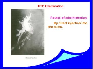 Biliary tract | PPSX