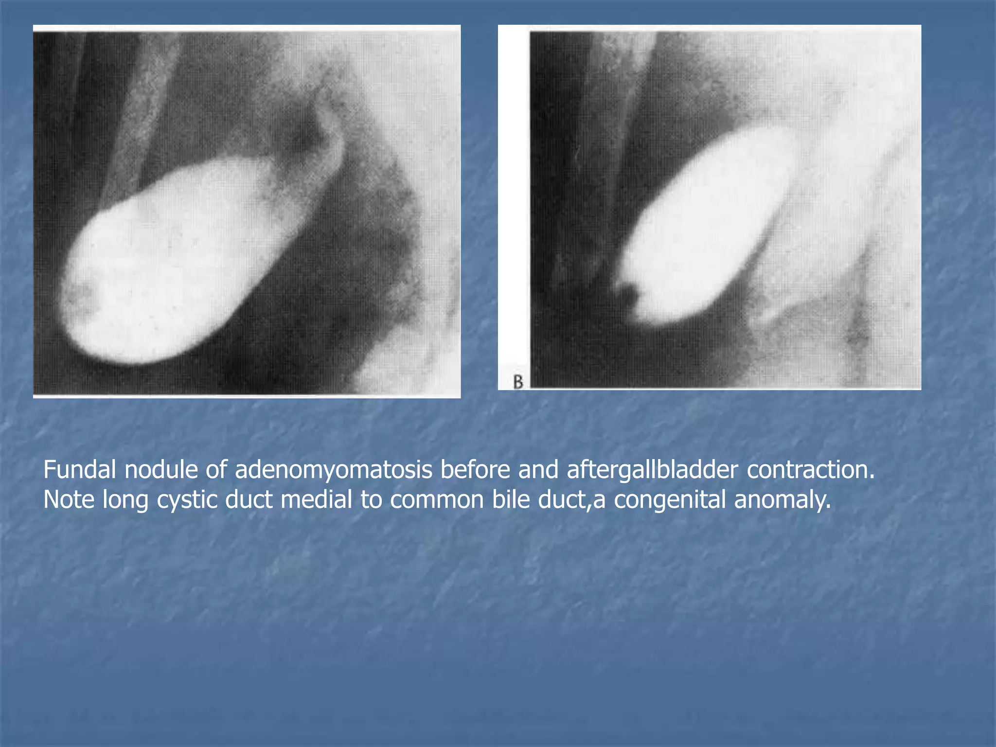 Biliary tract | PPT