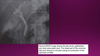 Biliary tract | PPTX