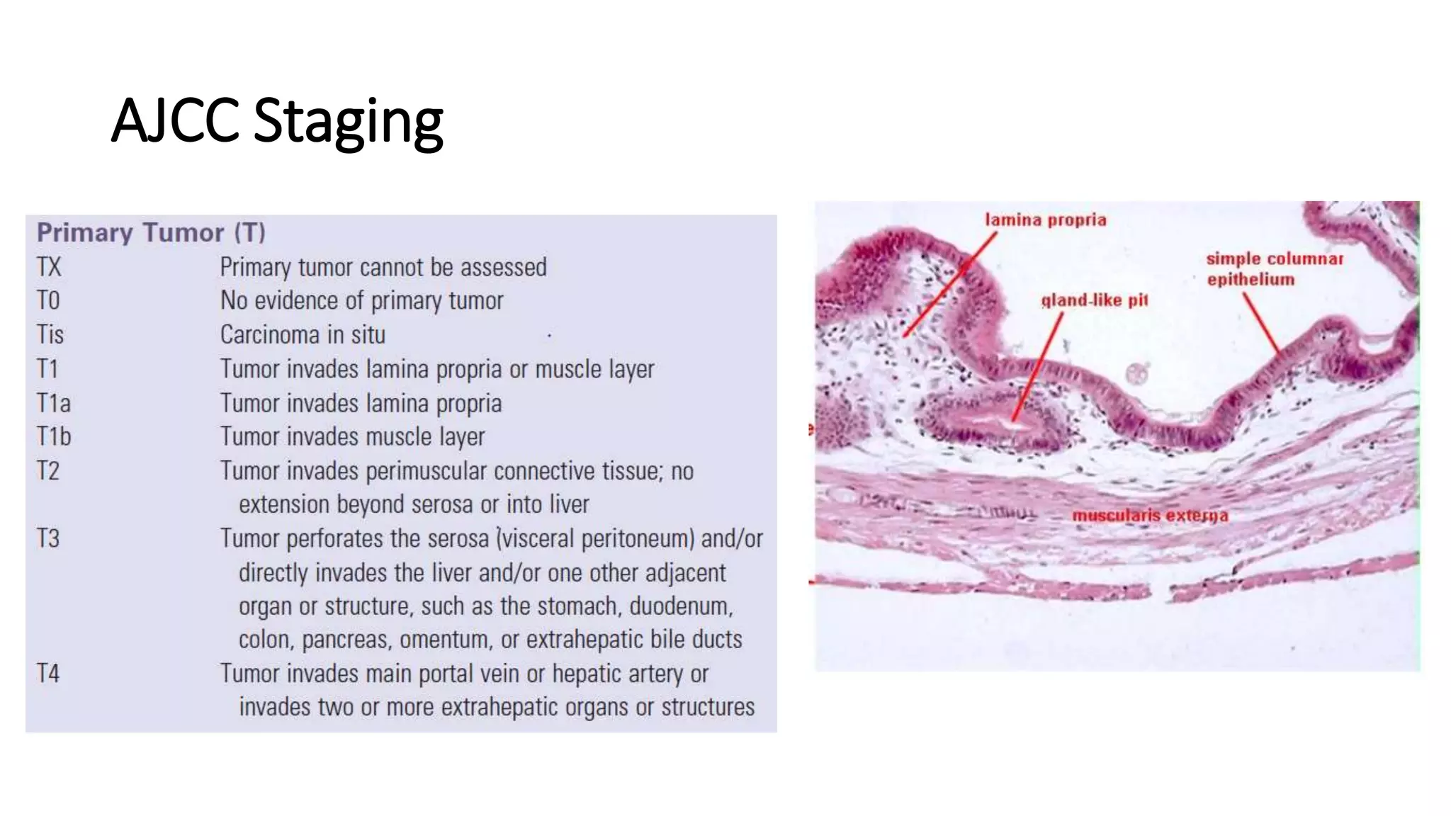 Biliary tract cancer | PPTX
