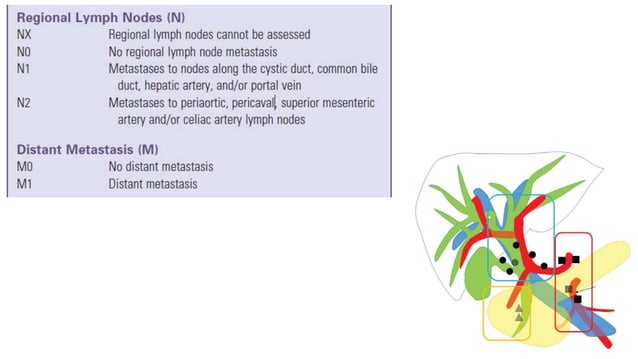 Biliary tract cancer | PPTX