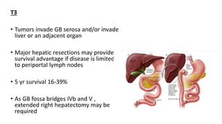 Biliary tract cancer | PPTX